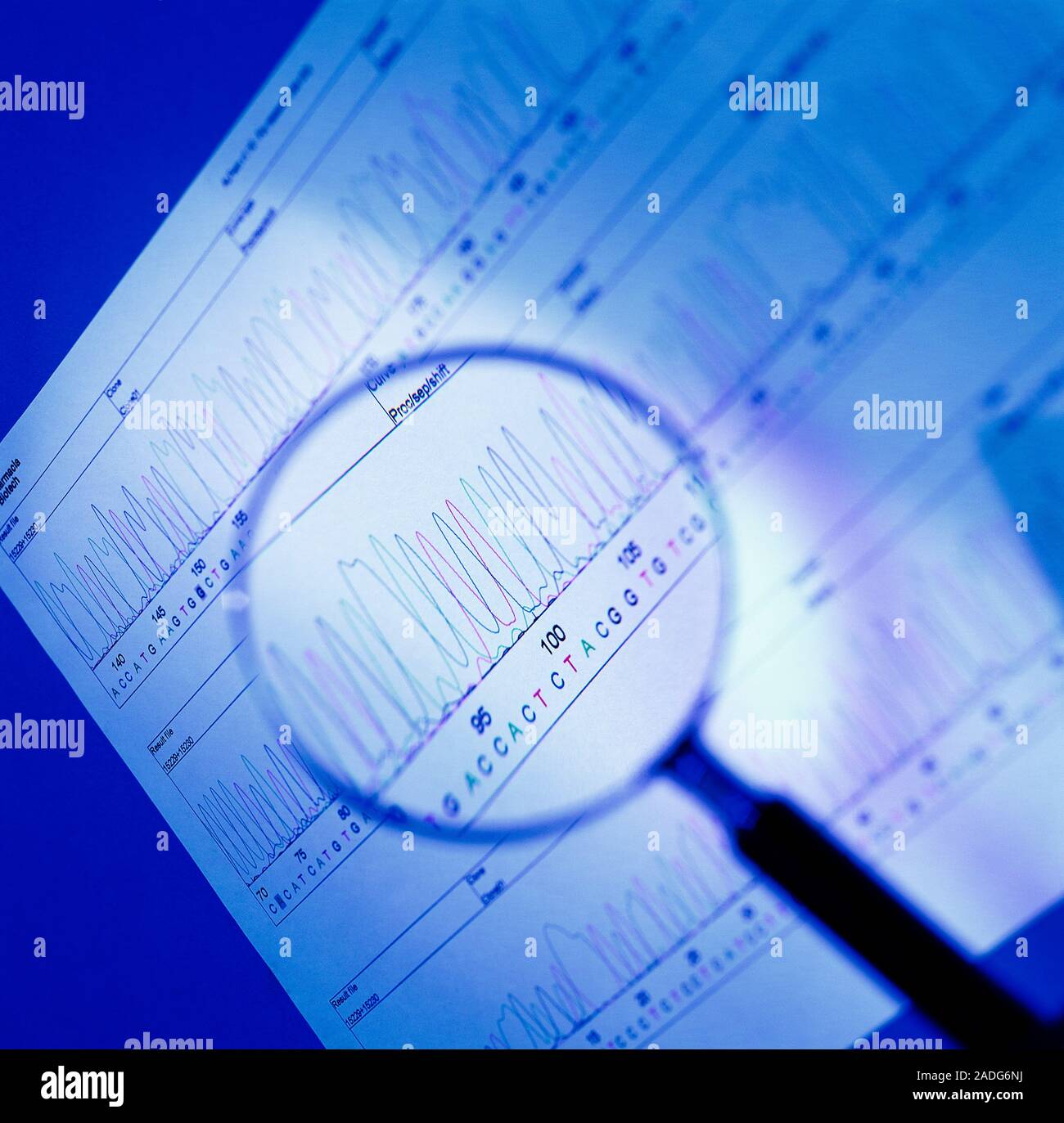 DNA analysis. Magnifying glass over graphs showing the results of DNA ...