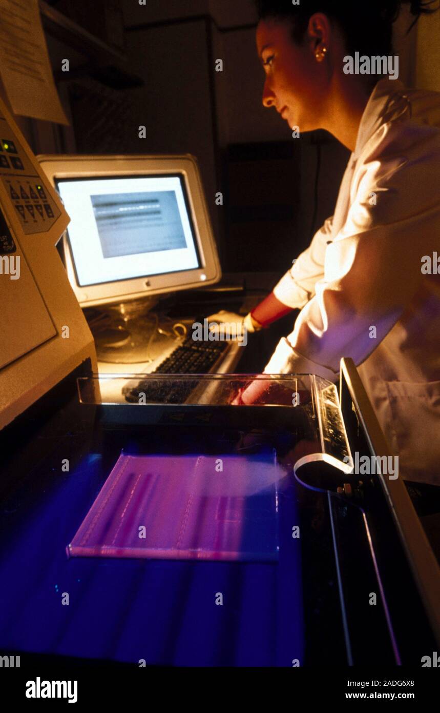 DNA ultraviolet electrophoresis. Researcher using an ultraviolet (UV ...
