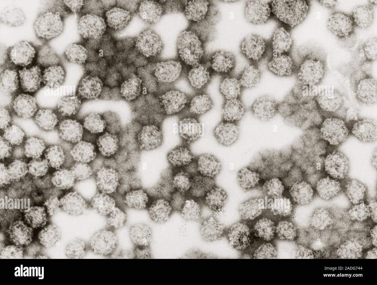 Transmission electron micrograph (TEM) of an experimental HIV-antigen ...