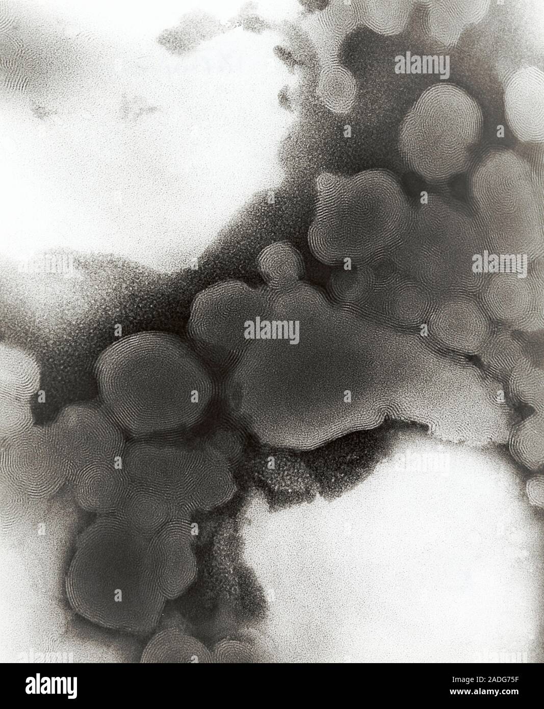 Liposome vesicles. Transmission electron micrograph (TEM) of a section ...