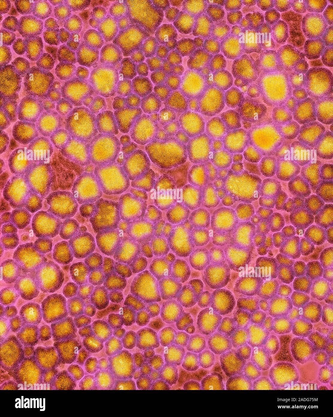 Liposome vesicles. Coloured transmission electron micrograph (TEM) of ...