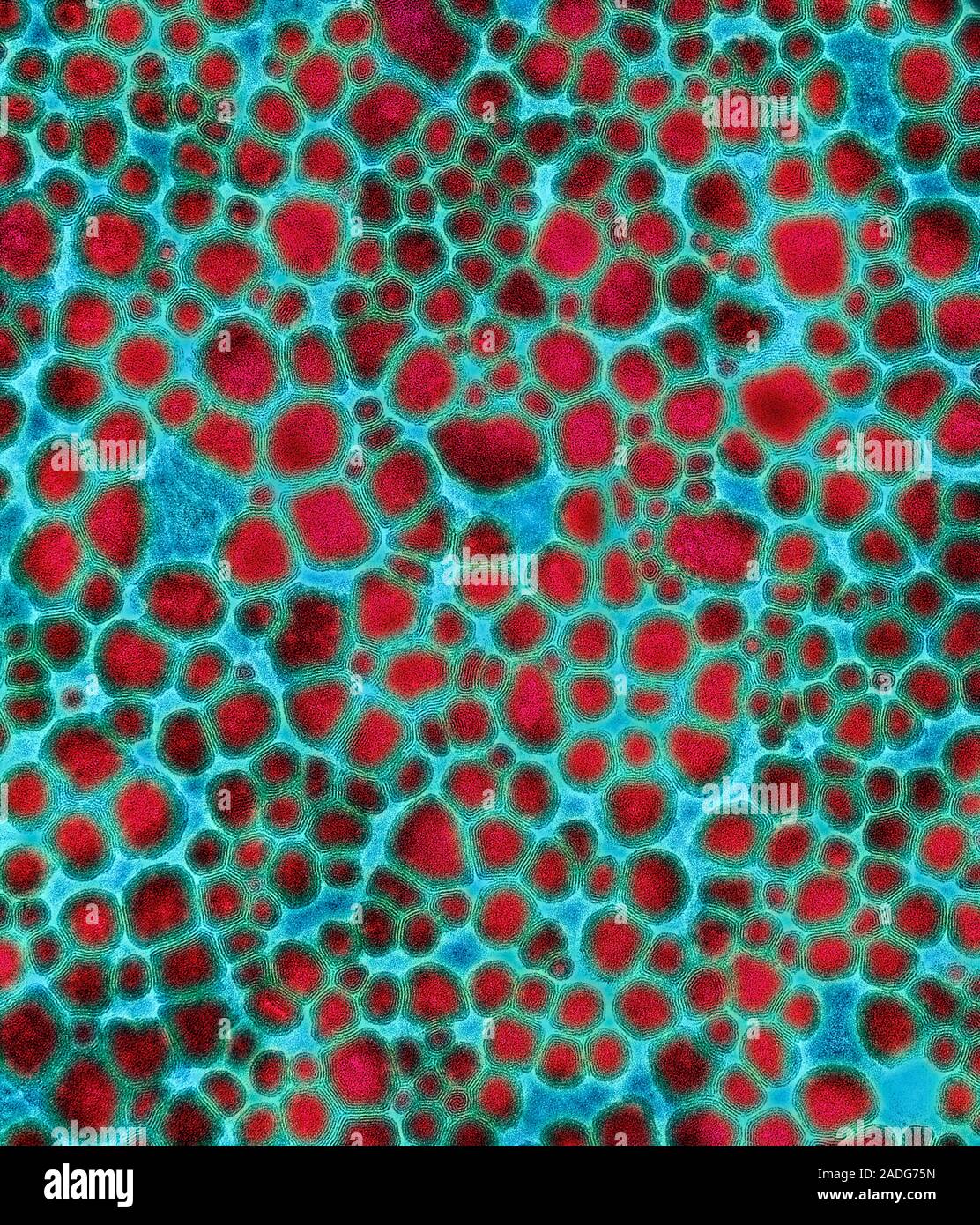 Liposome vesicles. Coloured transmission electron micrograph (TEM) of ...