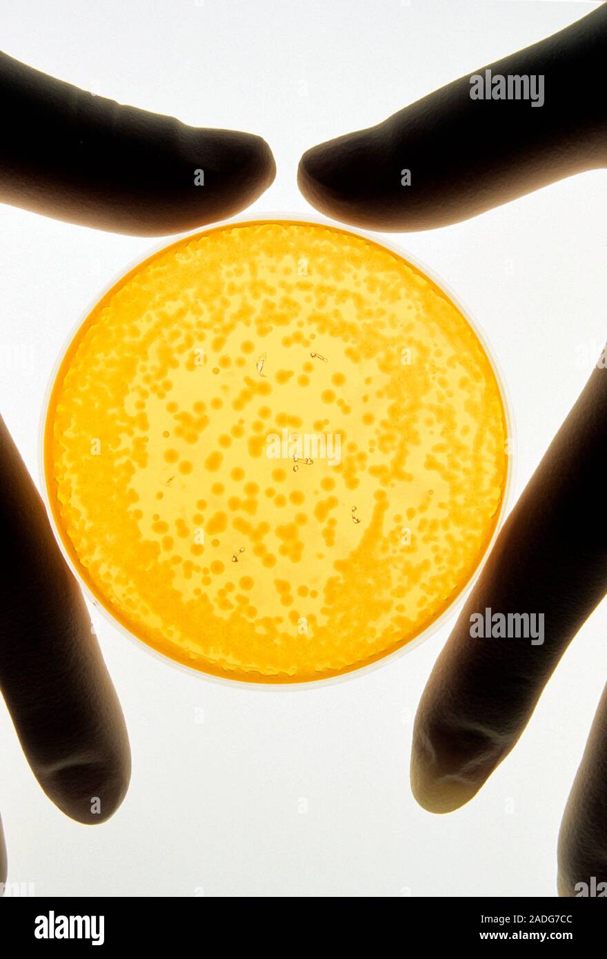 GM bacterial culture. Researcher examining a bacterial culture on a ...