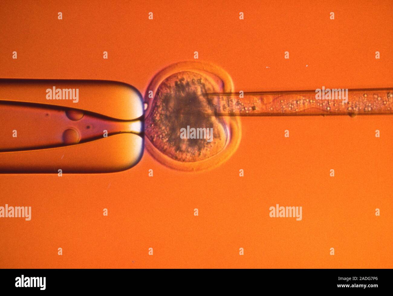 Dolly" cloning technique (second of 5 pictures). Light micrograph of a ...