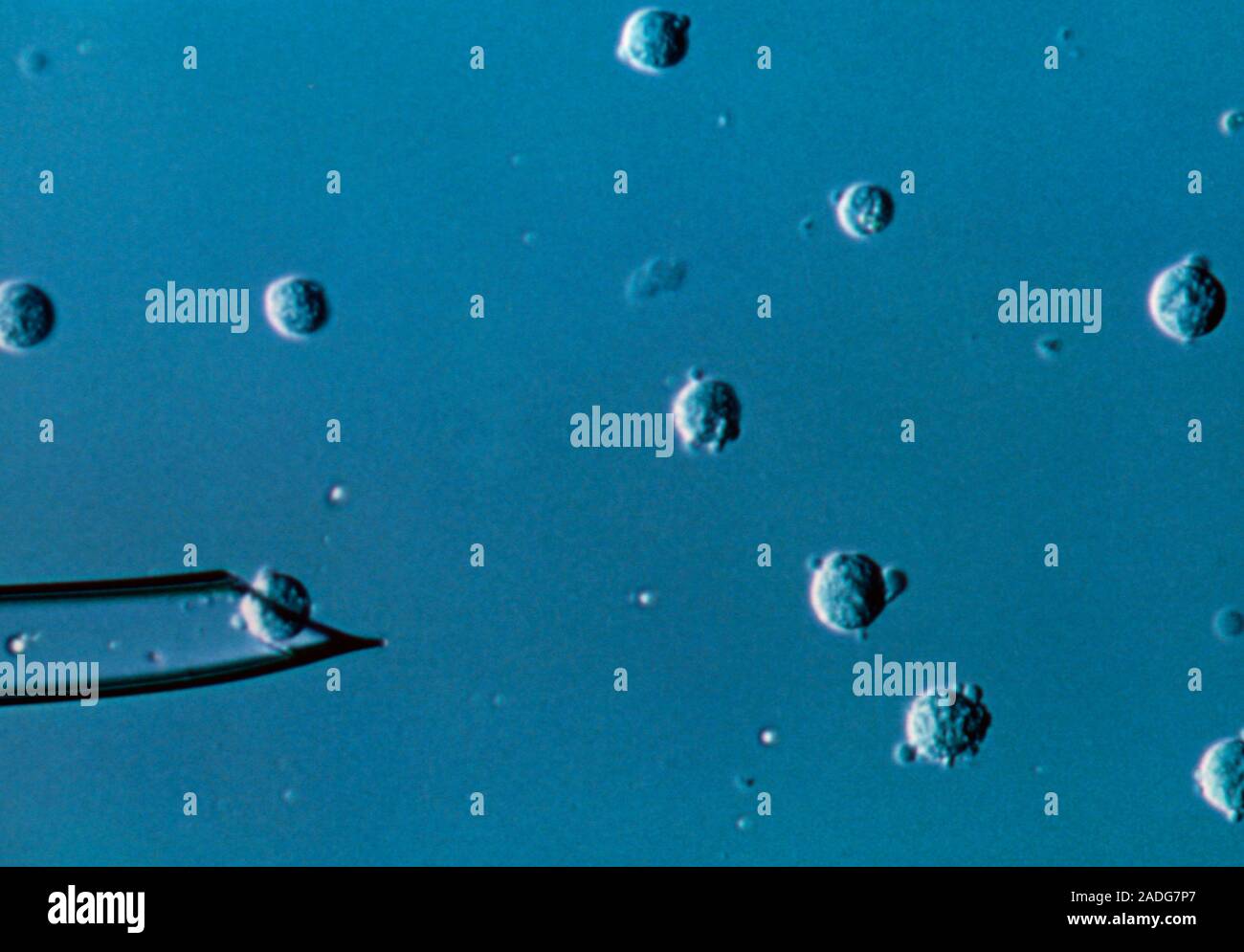 Dolly" cloning technique (third of 5 pictures). Light micrograph of ...