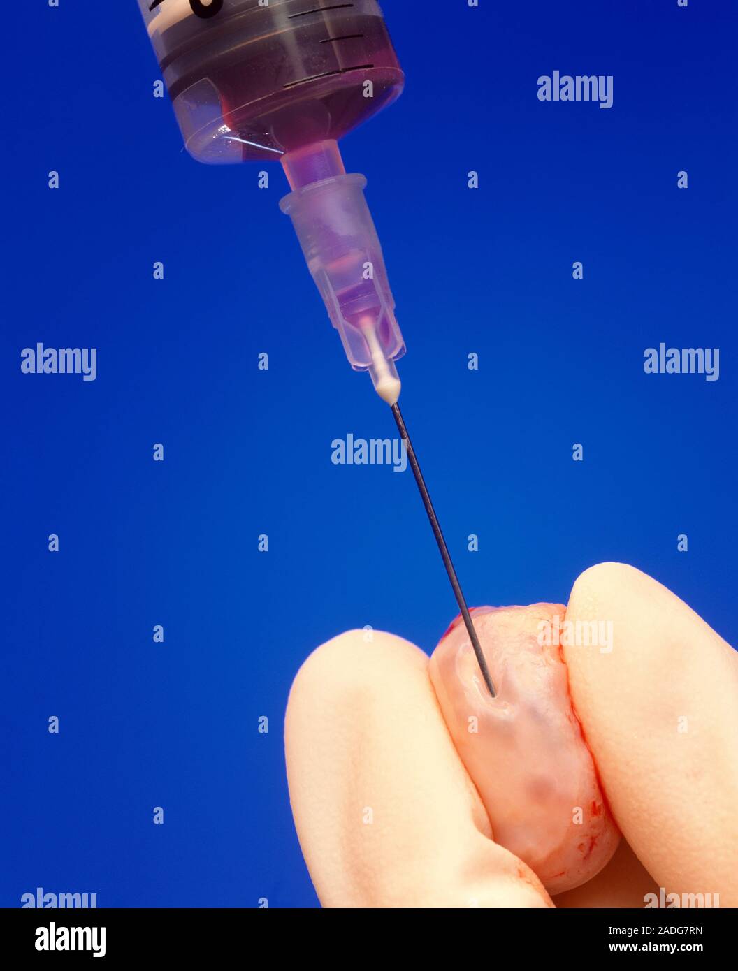 Cloning research. Researcher using a needle and syringe to extract ...