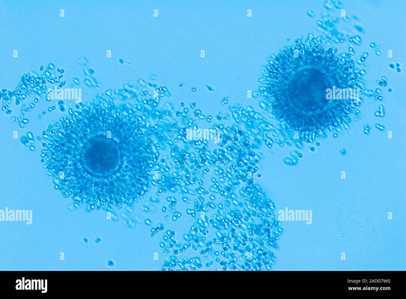 Cloning cows, nuclear transfer. Light micrograph of eggs (female ...