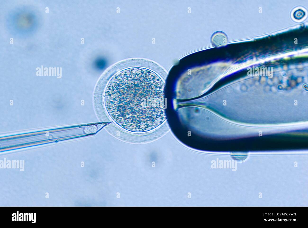 Cloning cows, nuclear transfer. Light micrograph of an egg (female ...