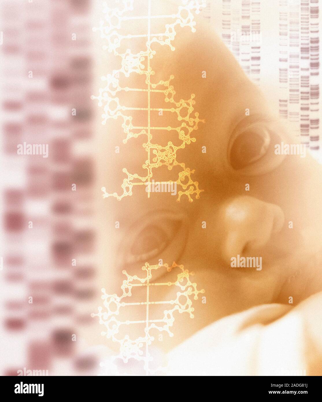 Human cloning. Conceptual computer artwork of a baby's face, part of ...