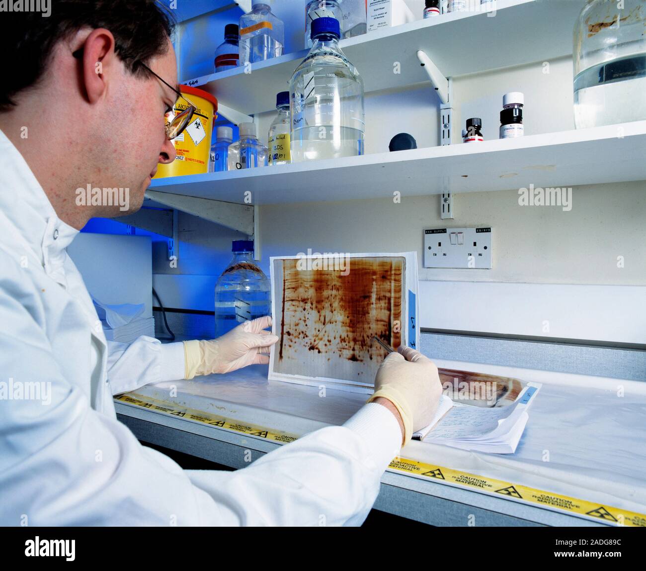 Proteomics research. Technician studying a copy of a 2-D gel used in ...