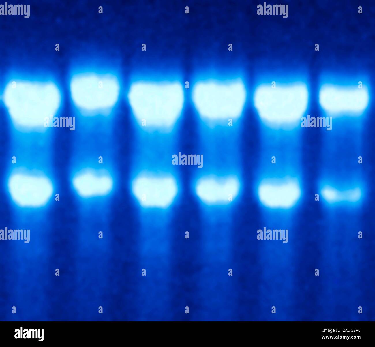 Liver RNA. Electrophoresis gel containing RNA (ribonucleic acid ...