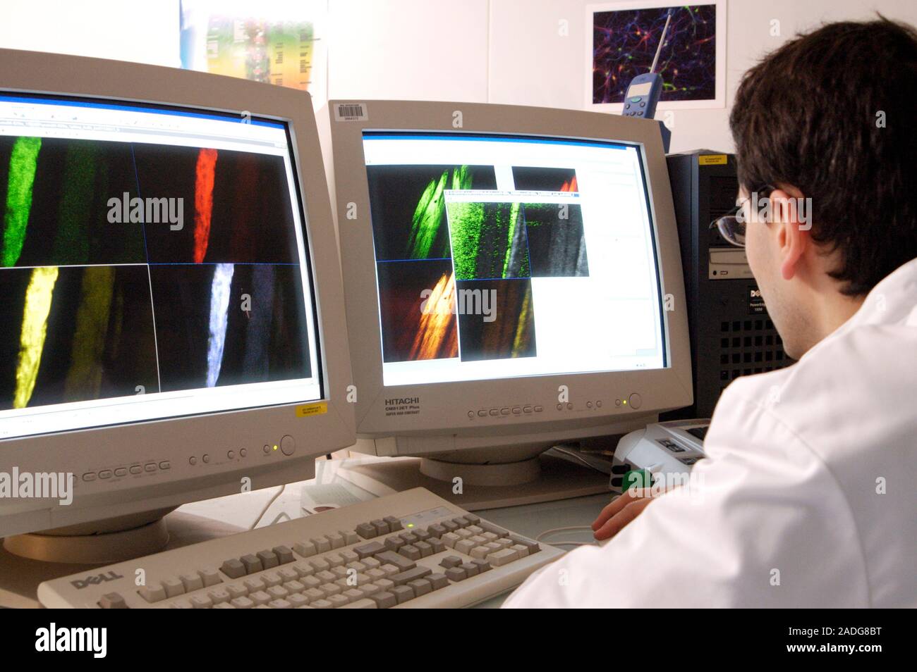 Biological research. Researcher examining cells displayed on two ...