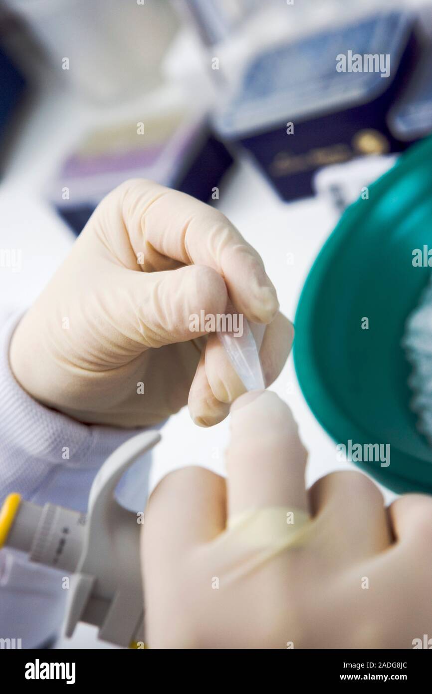 Muscle physiology research. Researcher handling a sample vial. The work ...
