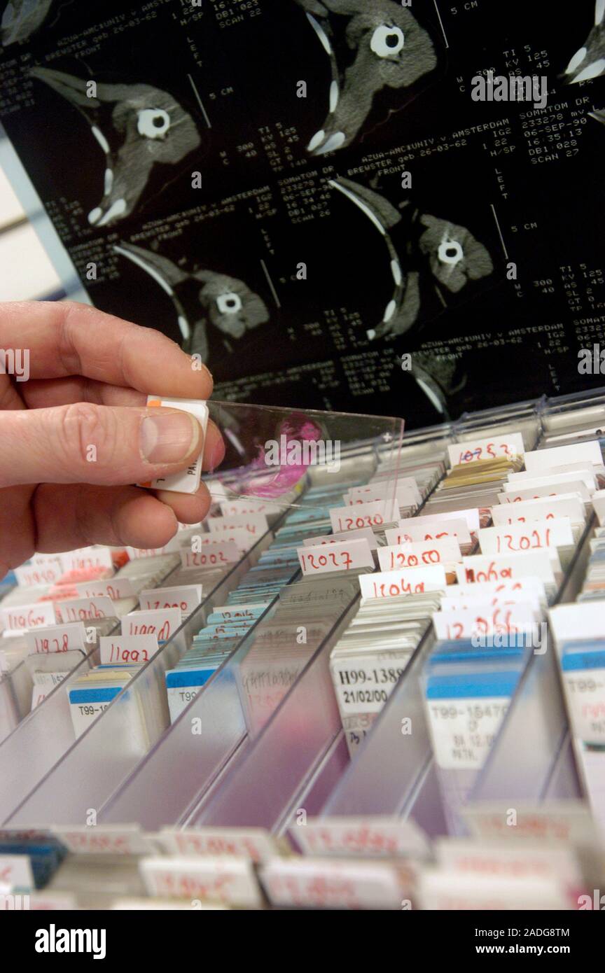 Histology microscope slides. Histologist removing a glass slide from a ...