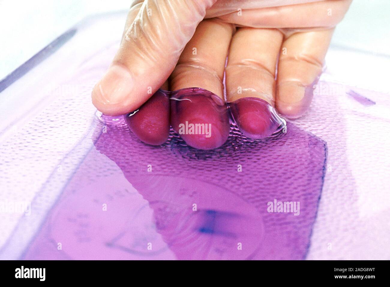 Proteomics research. Researcher staining a 2-D polyacrylamide gel used ...