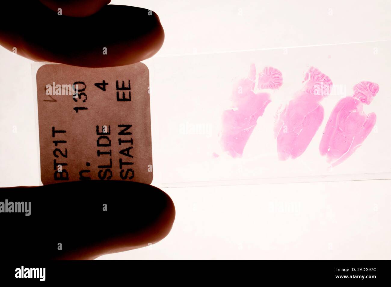 Rat brain microscope slides. Fingers hold a microscope slide of stained ...