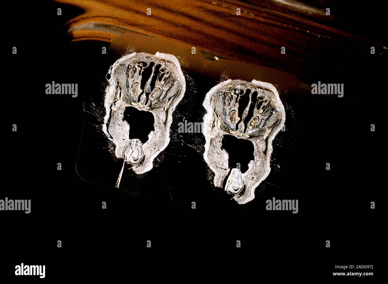 Rat brain sections. Sliced sections of a rats head embedded in wax and ...