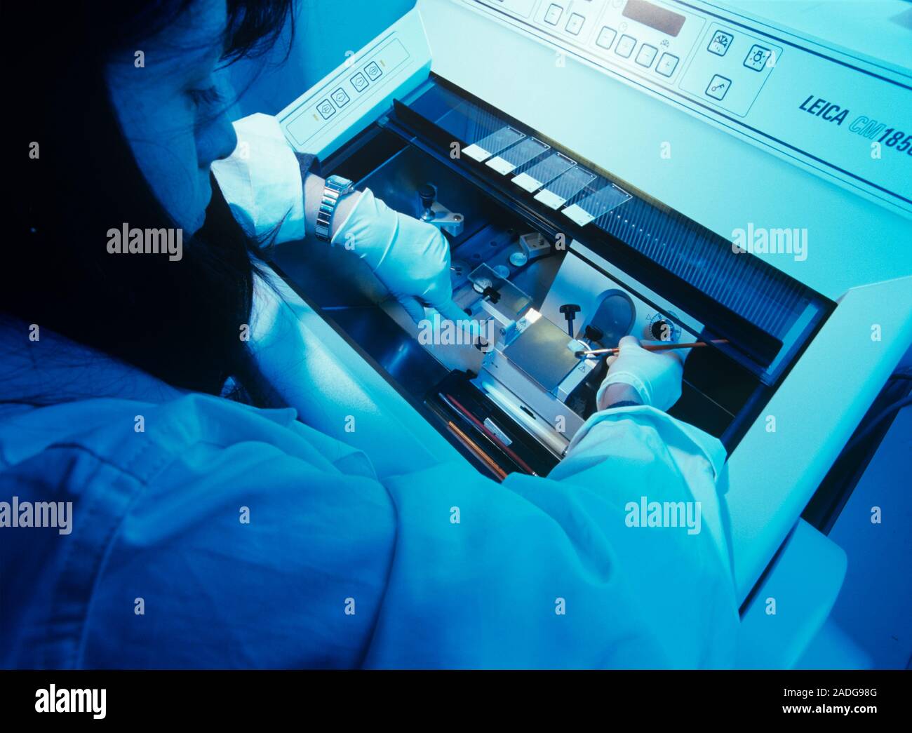 Mouse Pancreas Dissection Researcher Dissecting A Mouse Pancreas In A Cryostat A Cryostat Is A