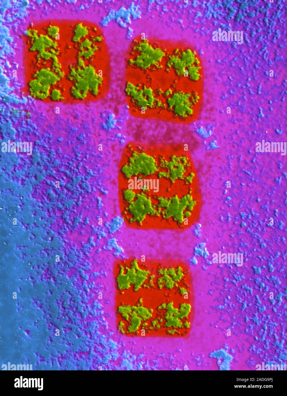 False Colour Transmission Electron Micrograph Tem Of A Human Monoclonal Antibody Human
