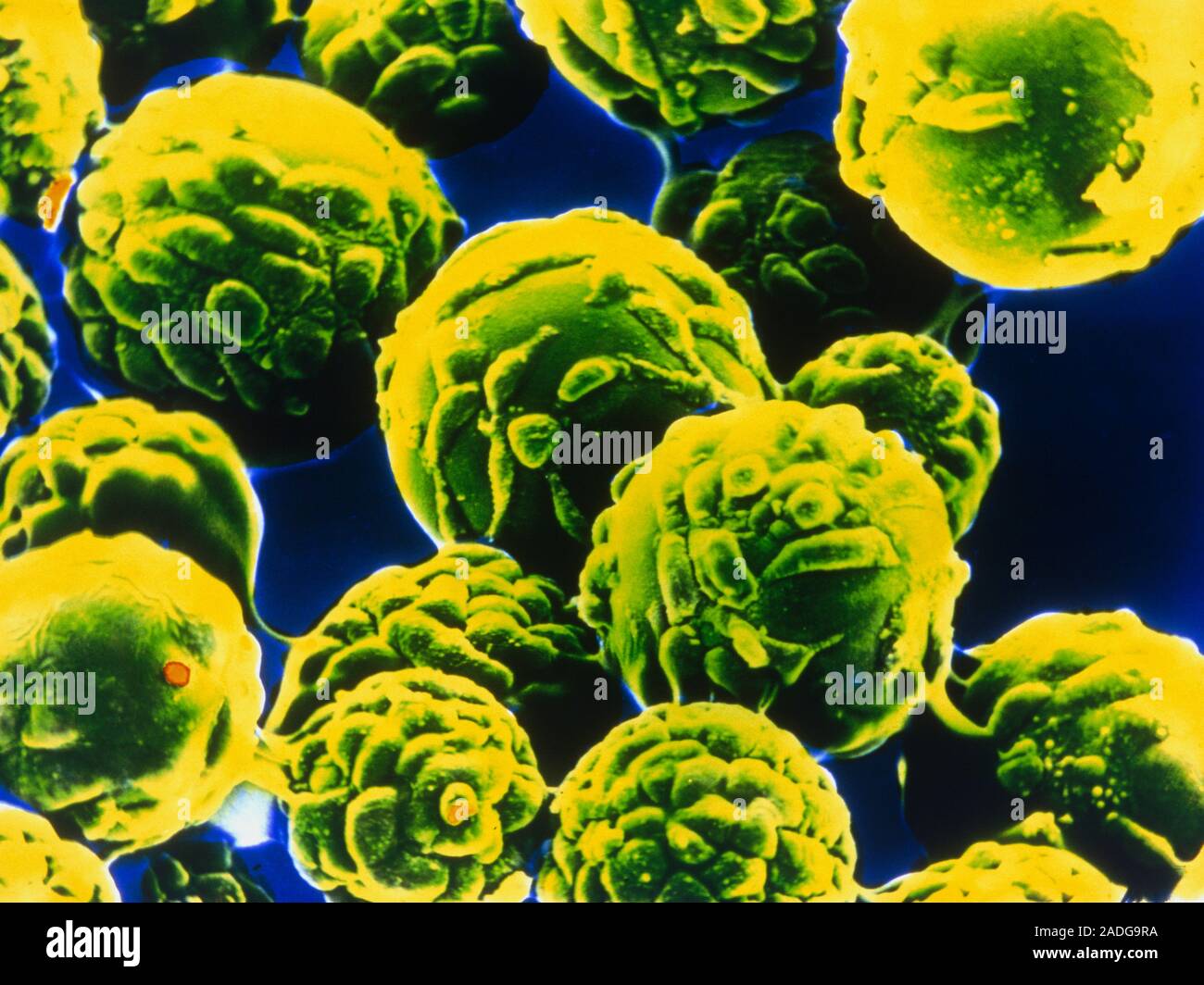 False colour scanning electron micrograph (SEM) of culture cells ...
