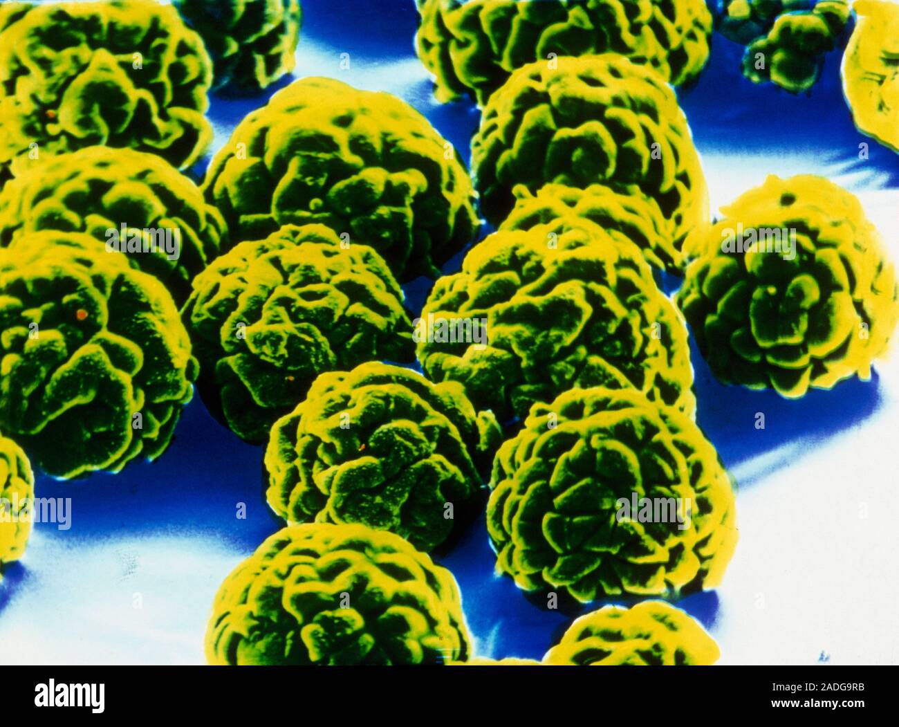 False colour scanning electron micrograph (SEM) of culture cells ...
