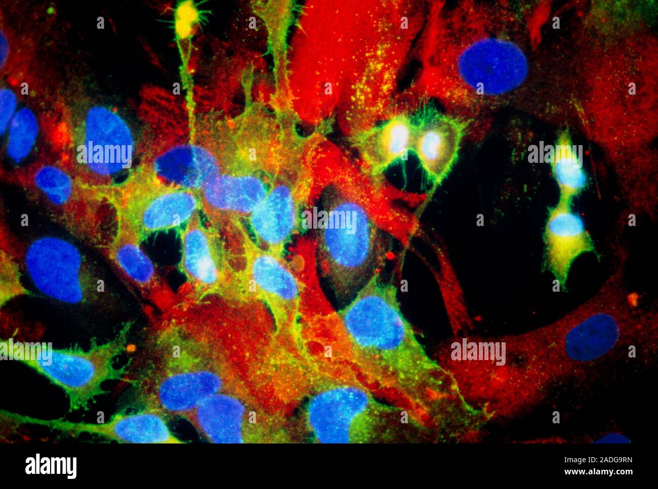 HeLa cells. Immunofluorescent light micrograph of a culture of HeLa ...