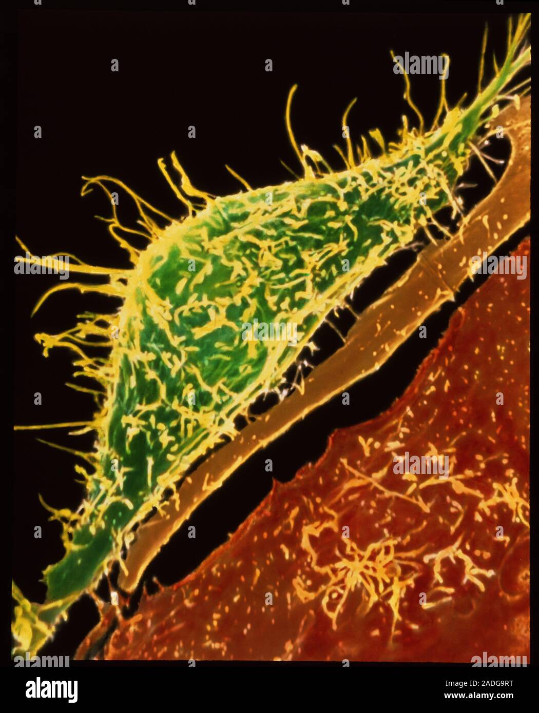 HeLa cell. Coloured Scanning Electron Micrograph (SEM) of a HeLa cell ...
