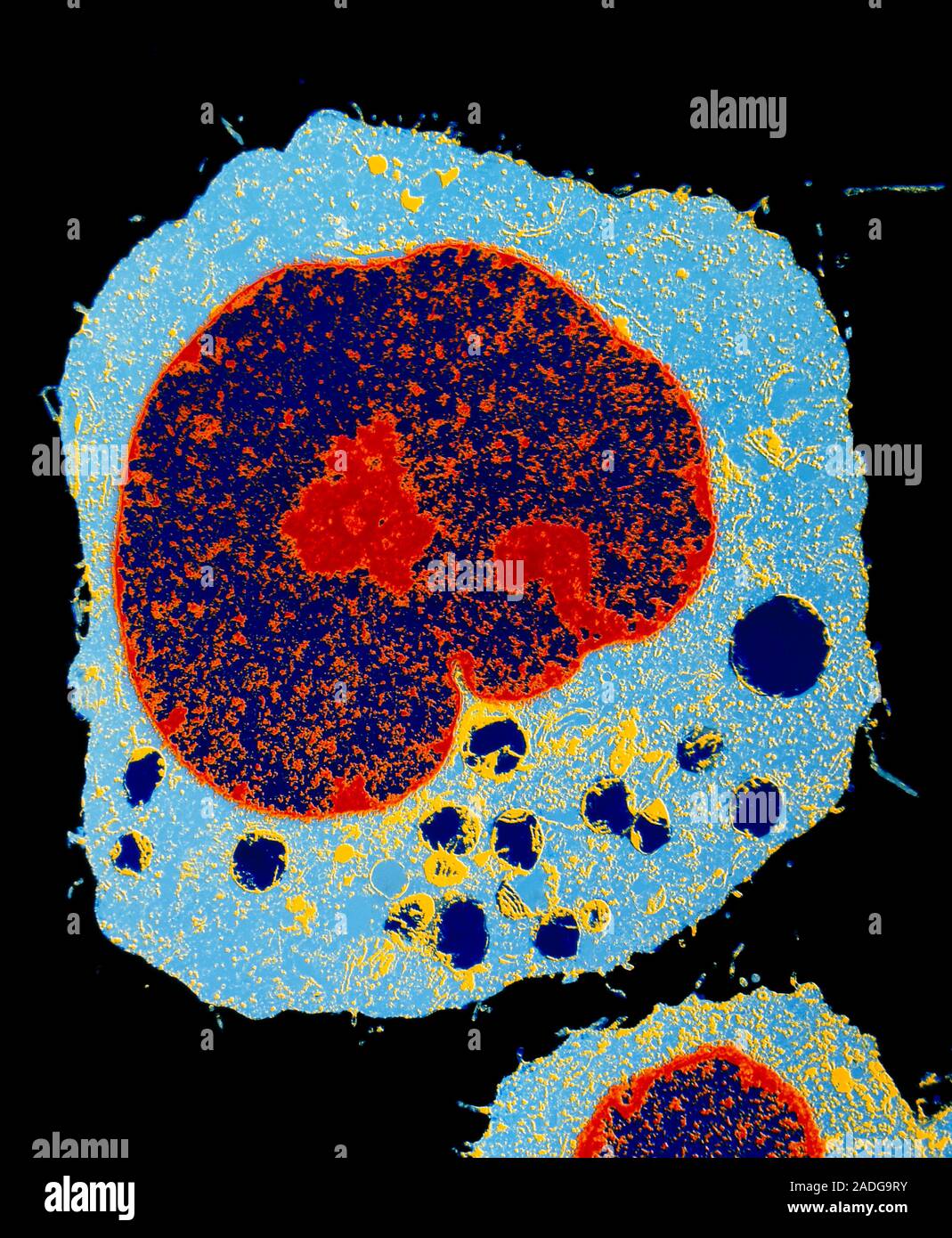 HeLa cell. Coloured transmission electron micrograph of a section of a ...