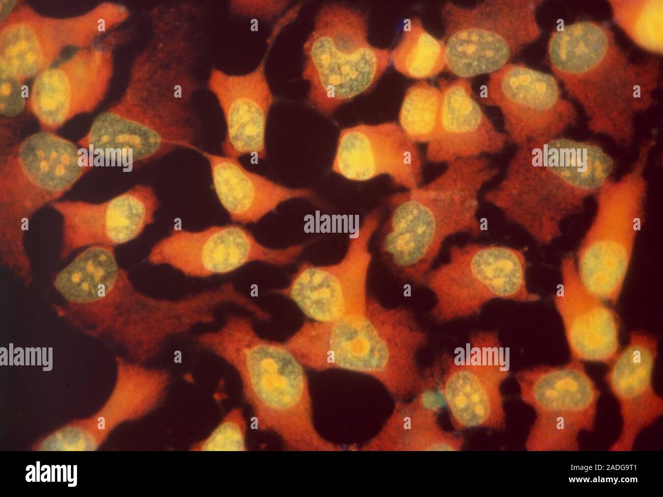 HeLa cells. Light micrograph (acridine orange stain) of a culture of ...