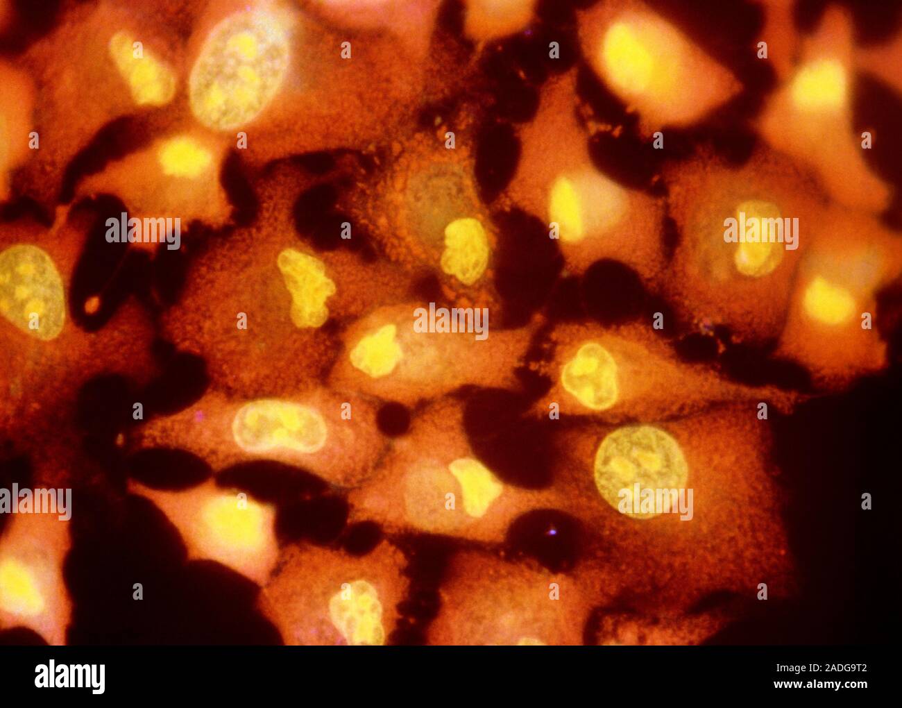 HeLa cells. Light micrograph (acridine orange stain) of a culture of ...
