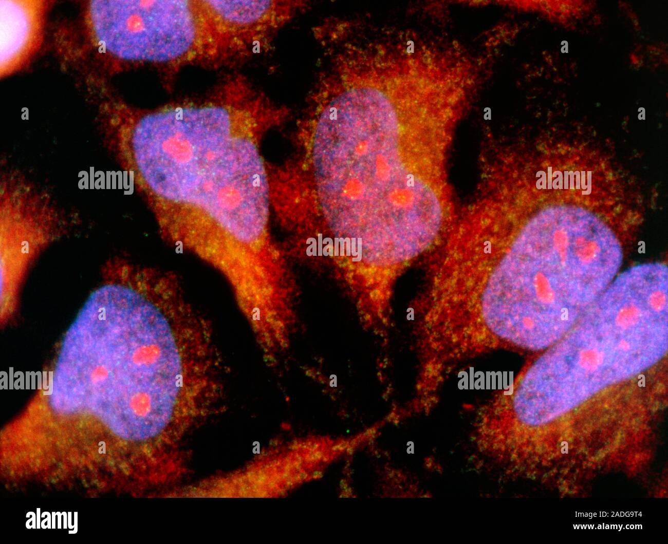 HeLa cell. Immunofluorescent light micrograph of cultured HeLa cancer ...
