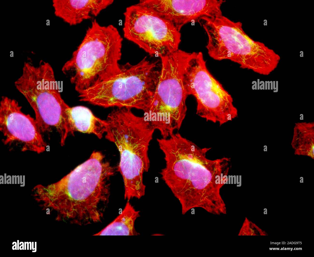 HeLa cancer cells. Immunofluorescent light micrograph of cultured HeLa ...