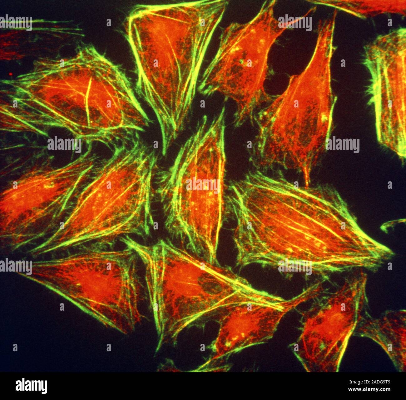 HeLa cells. Coloured immunofluorescent light micrograph (LM) of HeLa ...