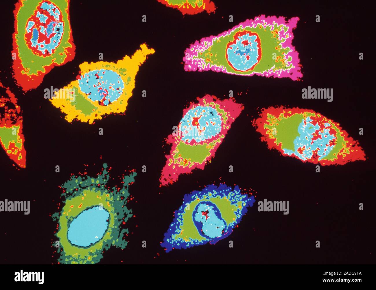 HeLa cells. Coloured light micrograph of HeLa cancer cells. The nuclei ...
