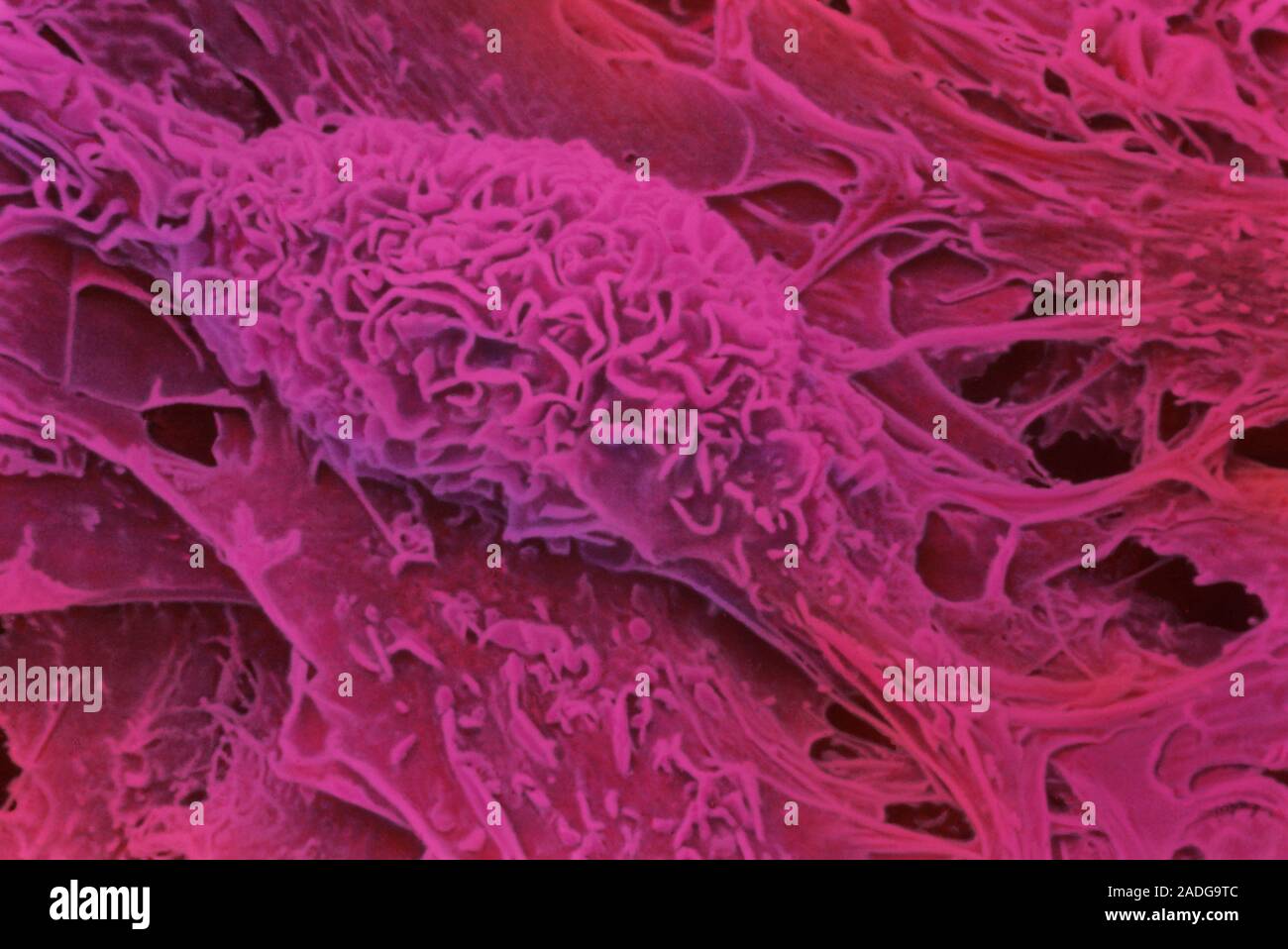 Embryonic stem cells. Coloured scanning electron micrograph (SEM) of ...