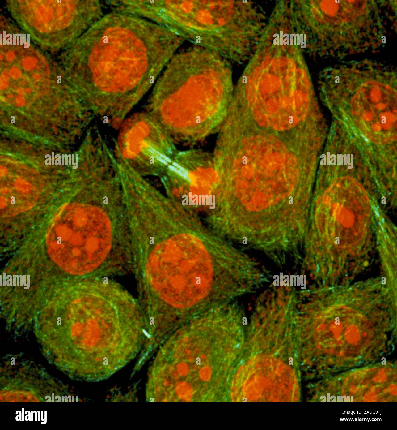 HeLa cells. Immunofluorescent light micrograph of HeLa cancer culture ...