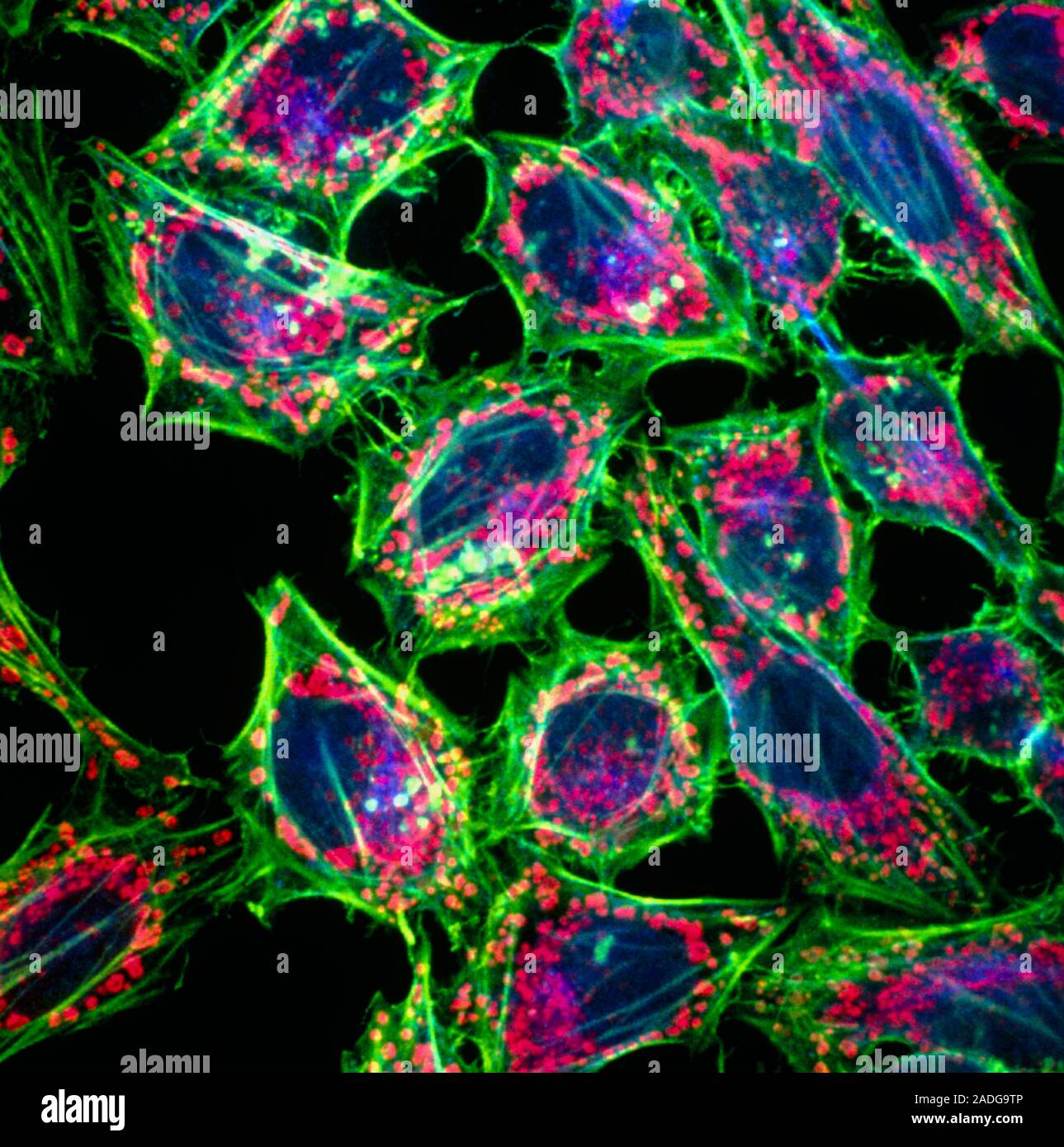 HeLa cells. Confocal light micrograph of HeLa cancer cells. The cells ...