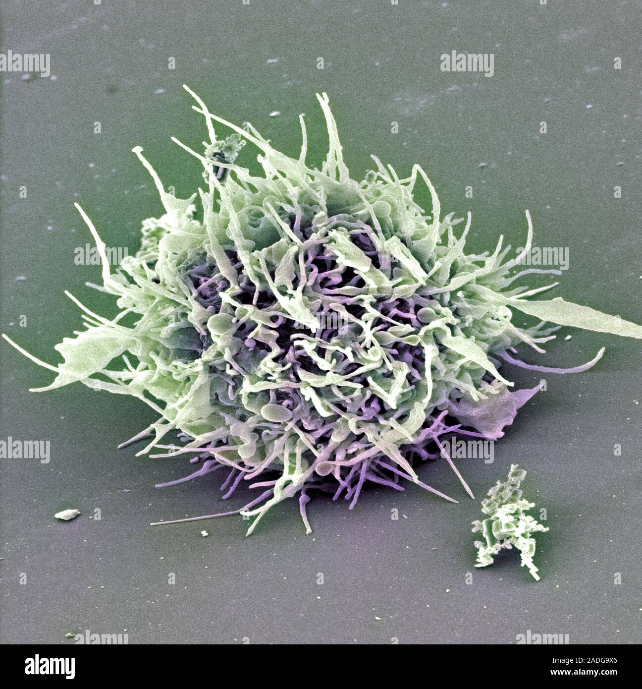 Stem cell coloured scanning electron micrograph (SEM). These cells are ...