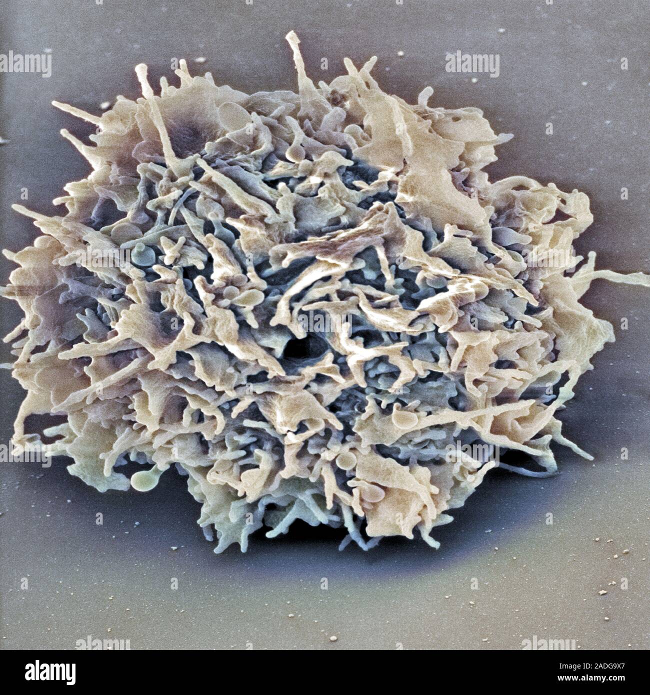 Stem cell coloured scanning electron micrograph (SEM). These cells are ...