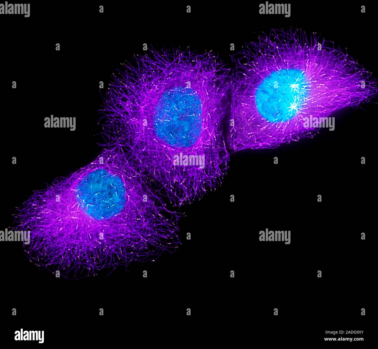 HaCaT cells. Immunofluorescence light micrograph of three HaCaT cells ...
