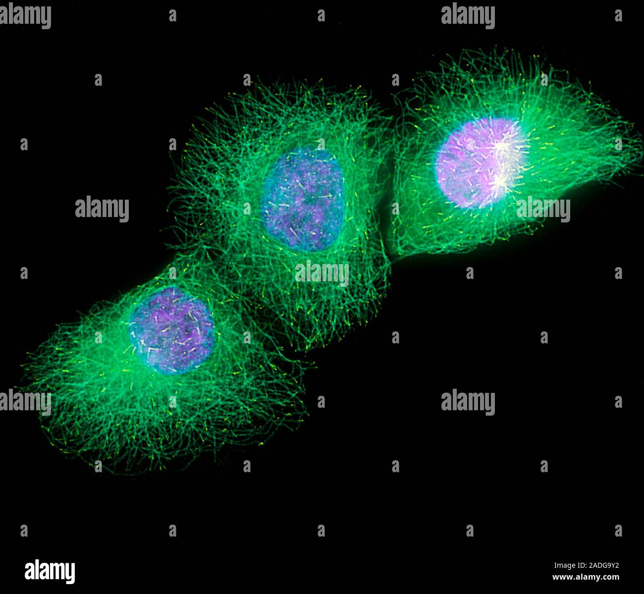 HaCaT cells. Immunofluorescence light micrograph of three HaCaT cells ...