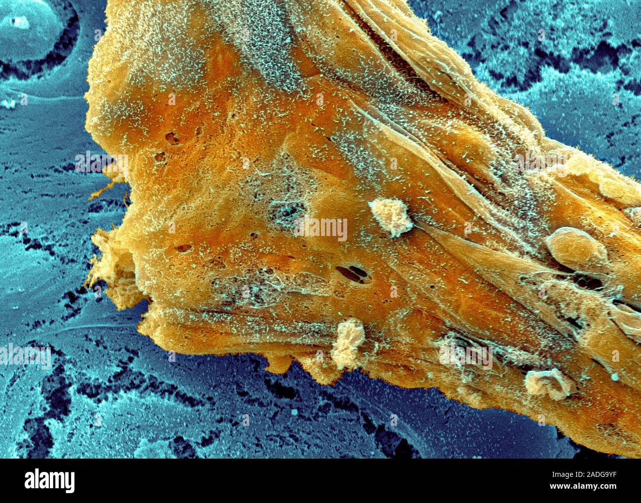 Stem Cells Coloured Scanning Electron Micrograph Sem Of A Group Of Differentiated Human