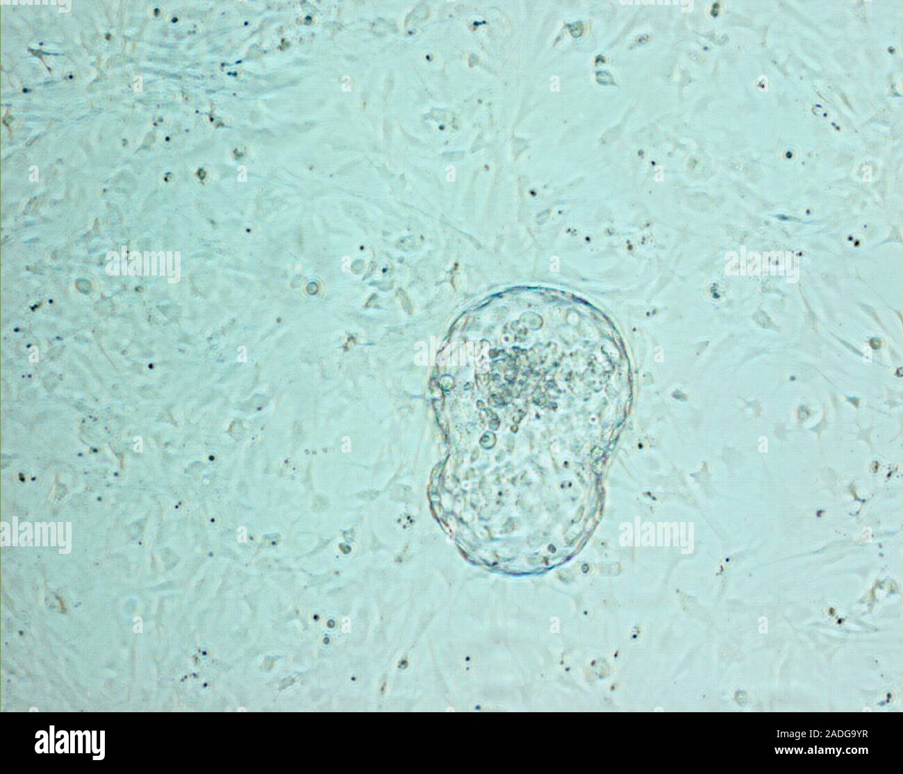 Hatching blastocyst. Light micrograph of a hatching human blastocyst, 7 ...