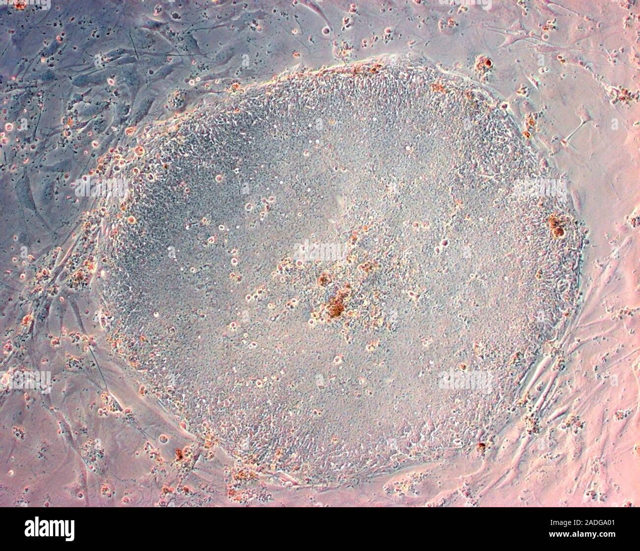 Stem cells. Coloured light micrograph of human embryonic stem cells ...