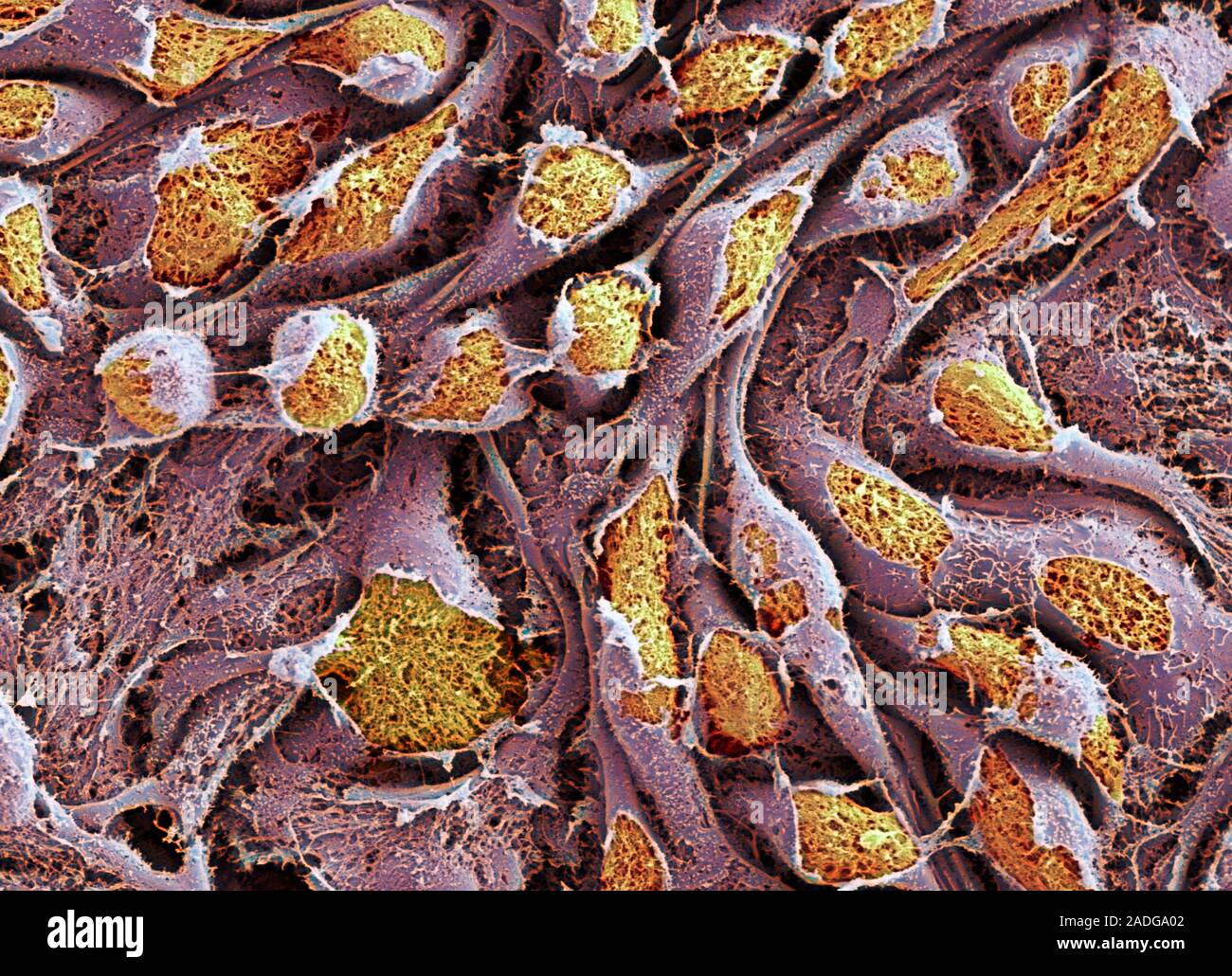 Stem cells. Coloured scanning electron micrograph (SEM) of groups of ...