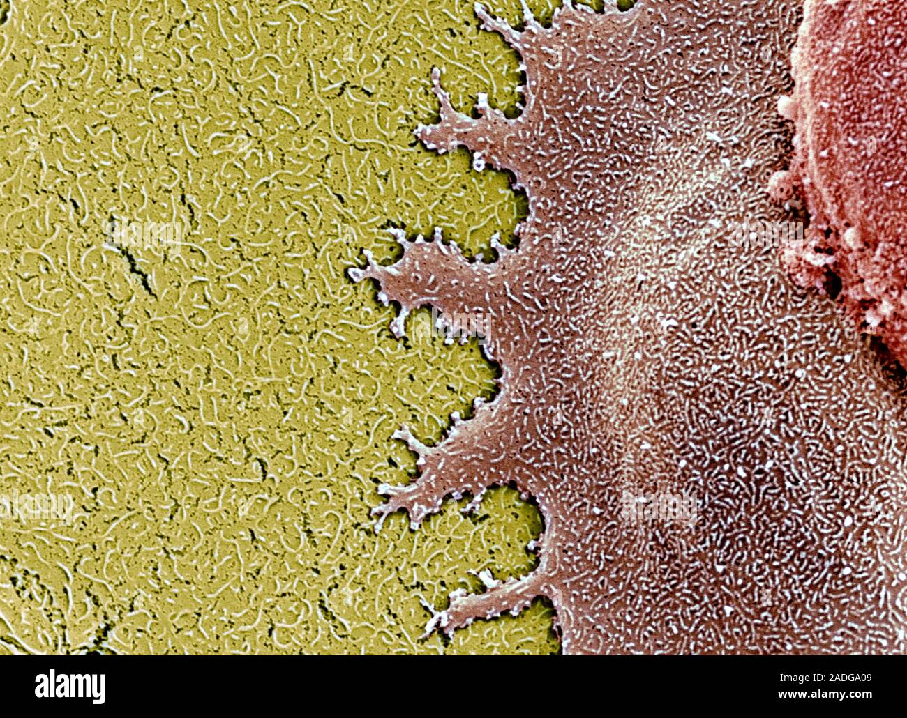 Stem cells. Coloured scanning electron micrograph (SEM) of two human ...