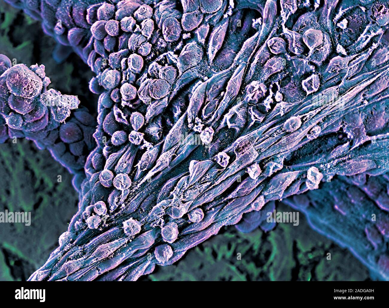 Stem cells. Coloured scanning electron micrograph (SEM) of groups of ...