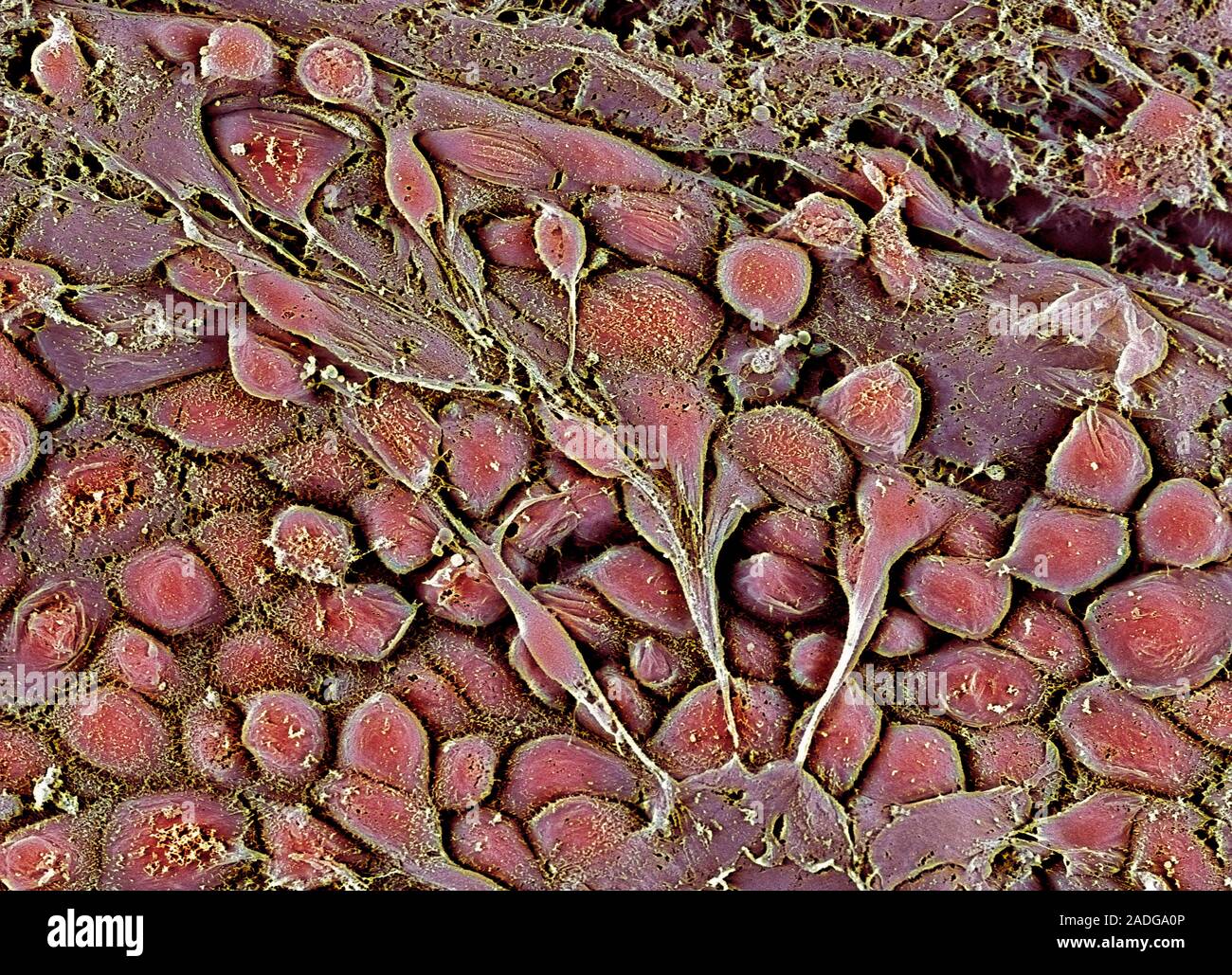 Stem cells. Coloured scanning electron micrograph (SEM) of human ...