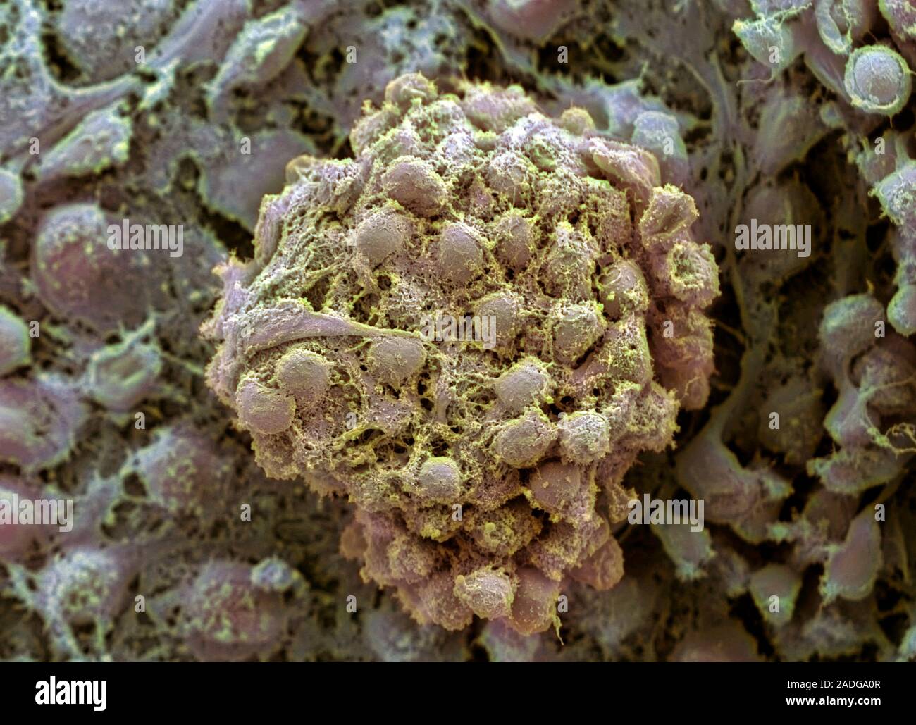 Stem cells. Coloured scanning electron micrograph (SEM) of human ...