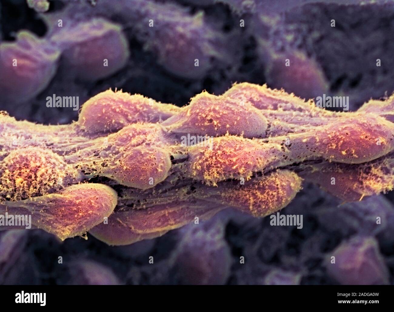 Stem cells. Coloured scanning electron micrograph (SEM) of human ...